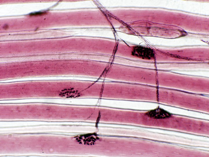 Virus letale — SoloTablet